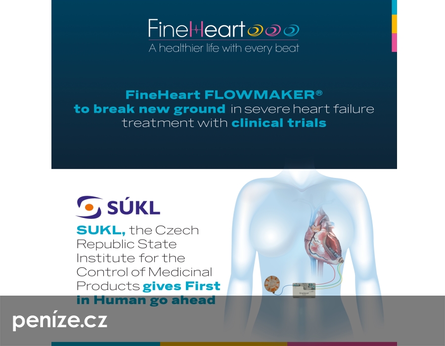 Společnost FineHeart získala souhlas českého zdravotního úřadu se ...
